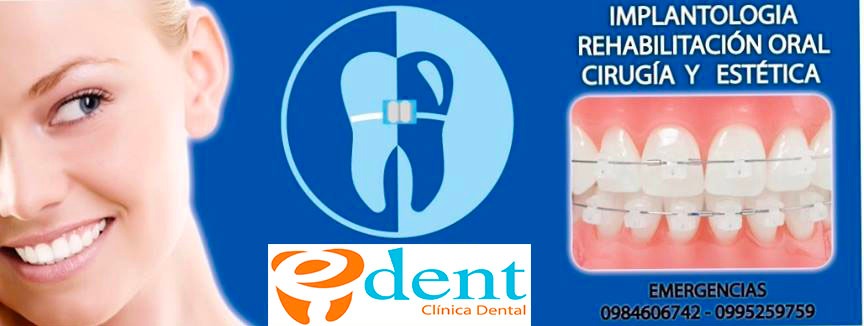 Edent-clinica-dental